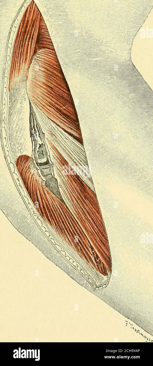 Elbow incision hi-res stock photography and images - Alamy