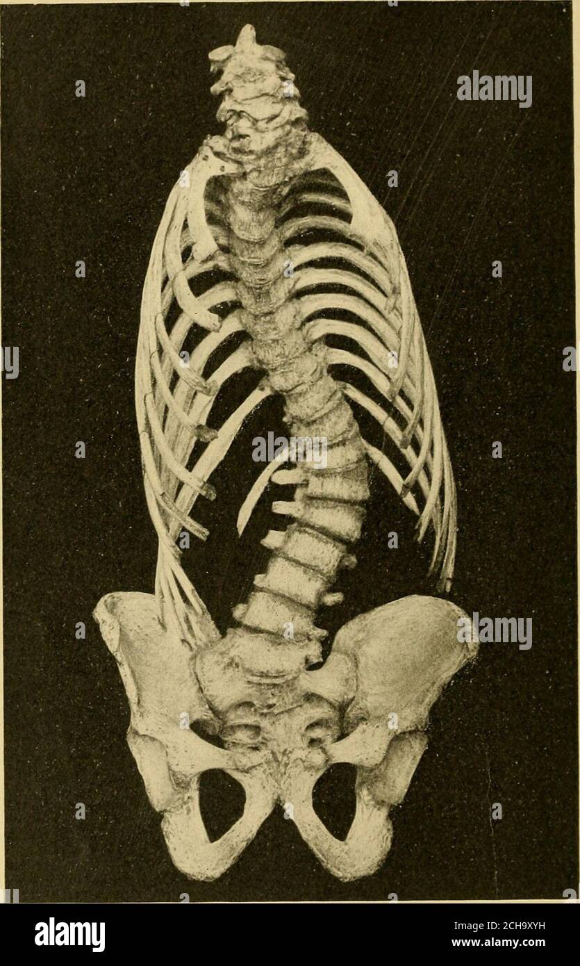 Lateral deviation hi-res stock photography and images - Alamy