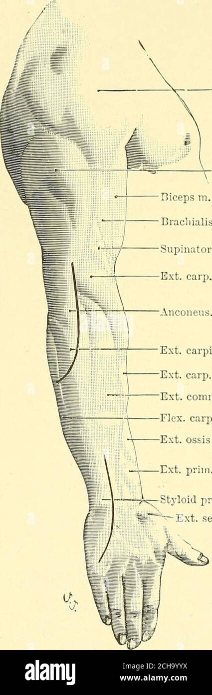 Elbow incision hi-res stock photography and images - Alamy