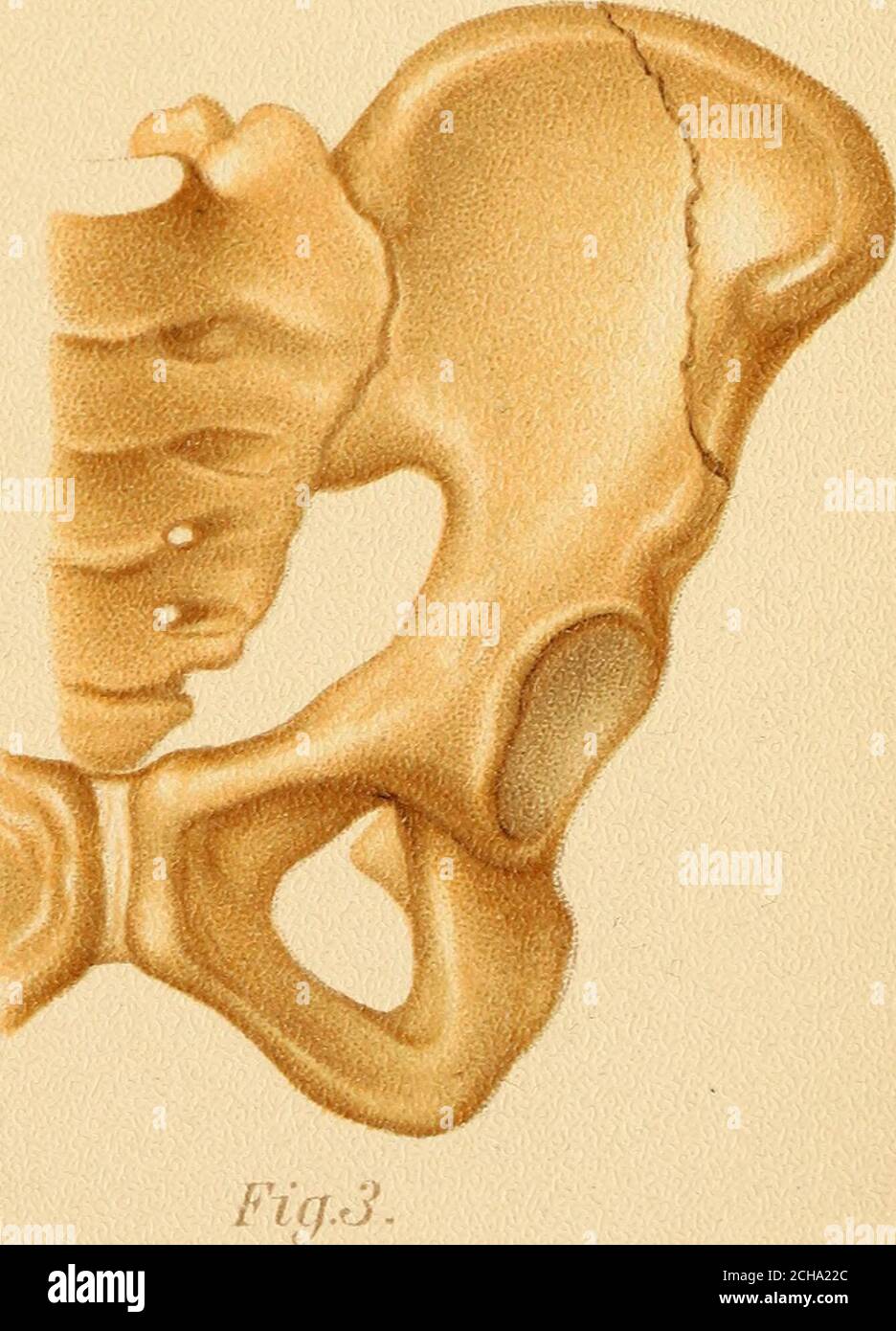 . Atlas and epitome of traumatic . Fig.?.. FRACTURES OF THE LOWER ...