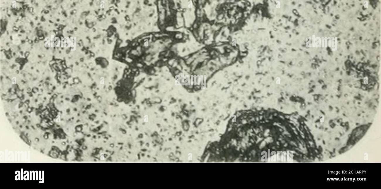 Iodine reactions hi-res stock photography and images - Alamy