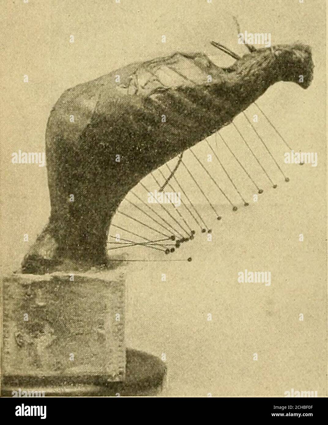 . Lateral curvature of the spine and round shoulders . be consideredas ...