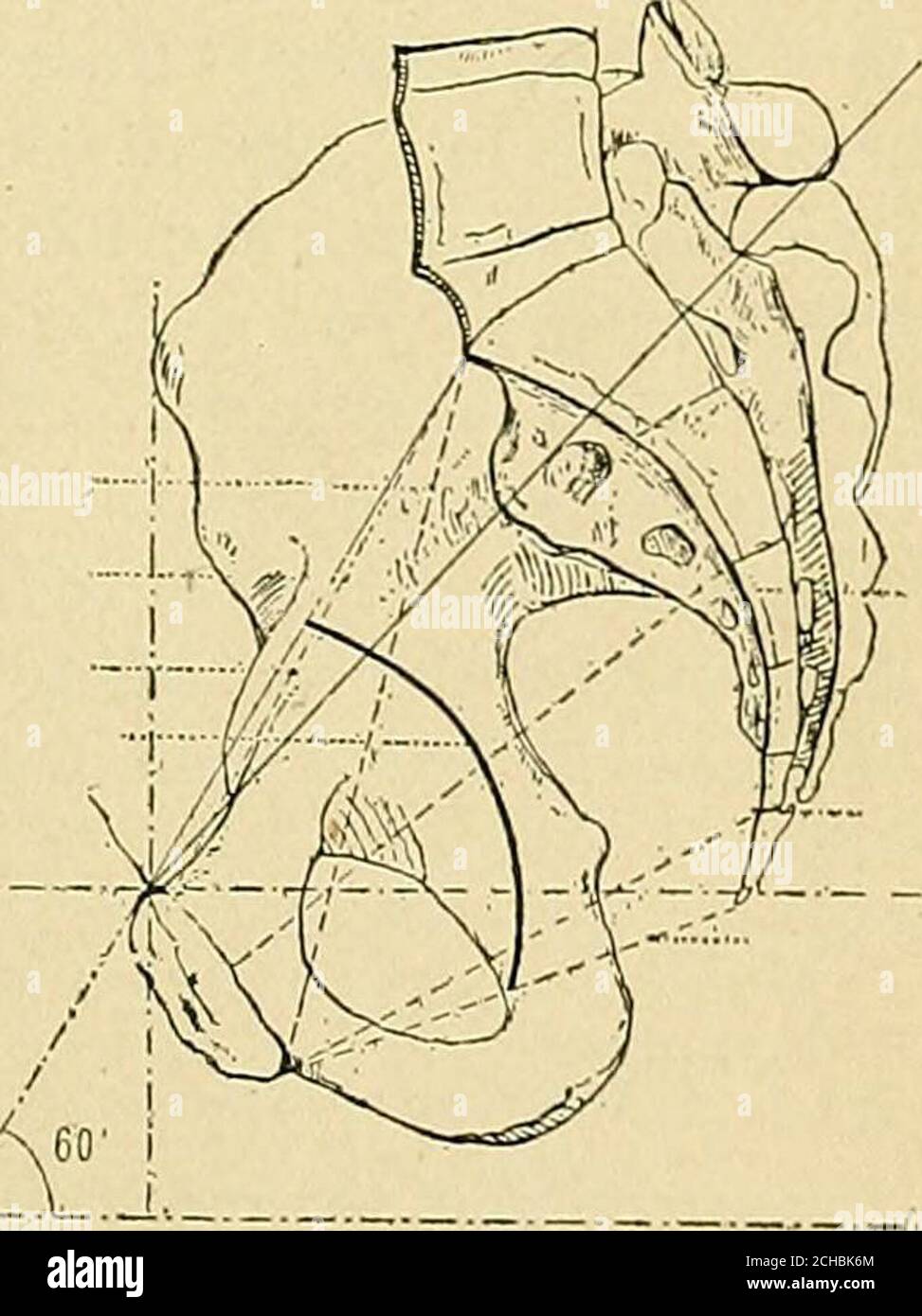 . Lateral curvature of the spine and round shoulders . centimeters ...