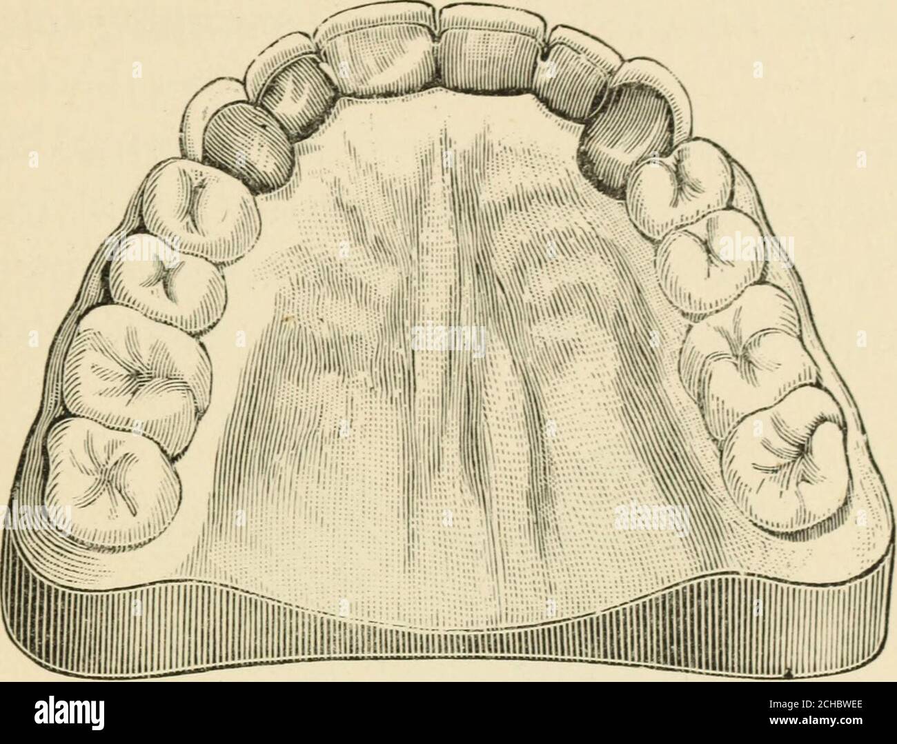 . The teeth in health and disease . Fig. 82.—Six front teeth prepared ...