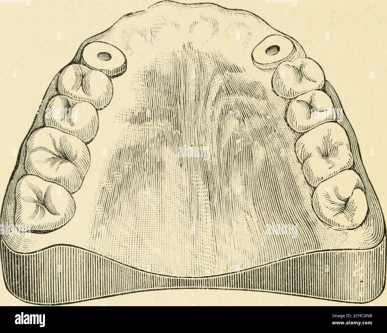. The teeth in health and disease . Fig. 80. Fig. 80 shows the ...