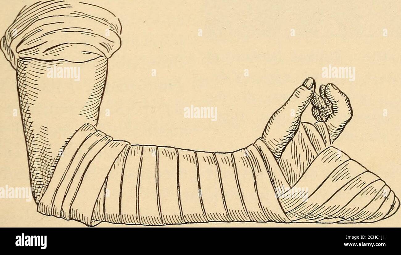 Volar surface hi-res stock photography and images - Alamy