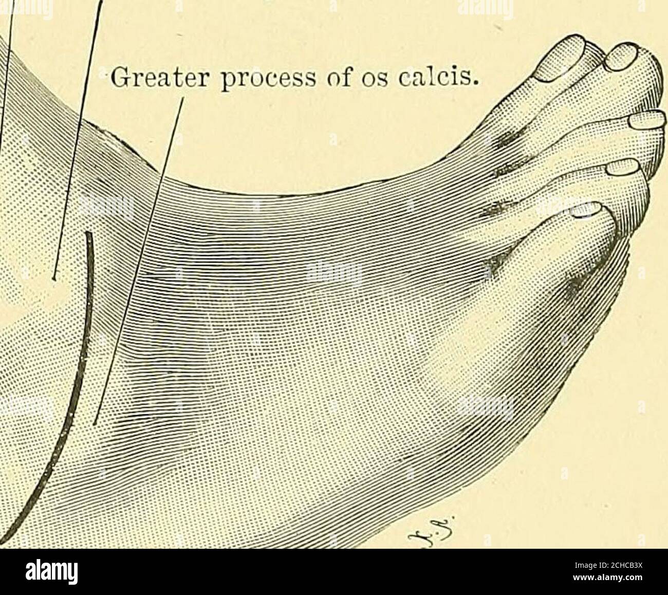 . Text-book of operative surgery . is reconstructed. The Operation ...