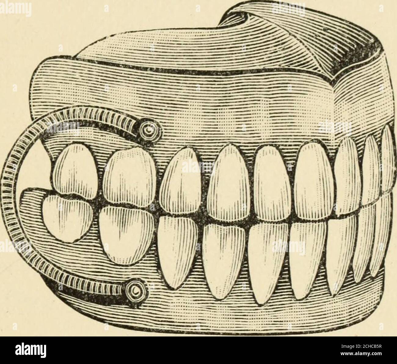 Vulcanite denture hi-res stock photography and images - Alamy