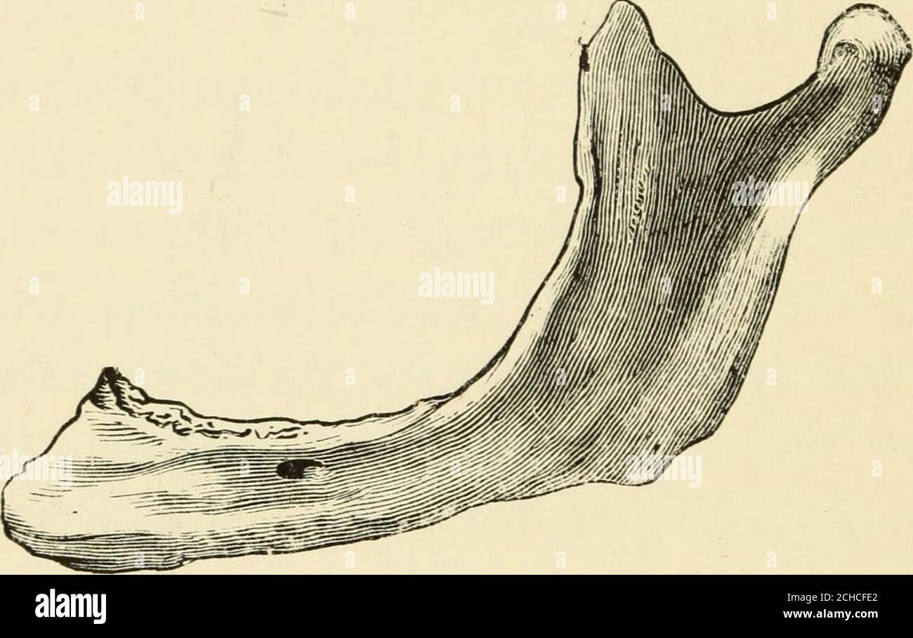 . The teeth in health and disease . Fig. 72.. Fig. 73. Fig. 72.—The ...