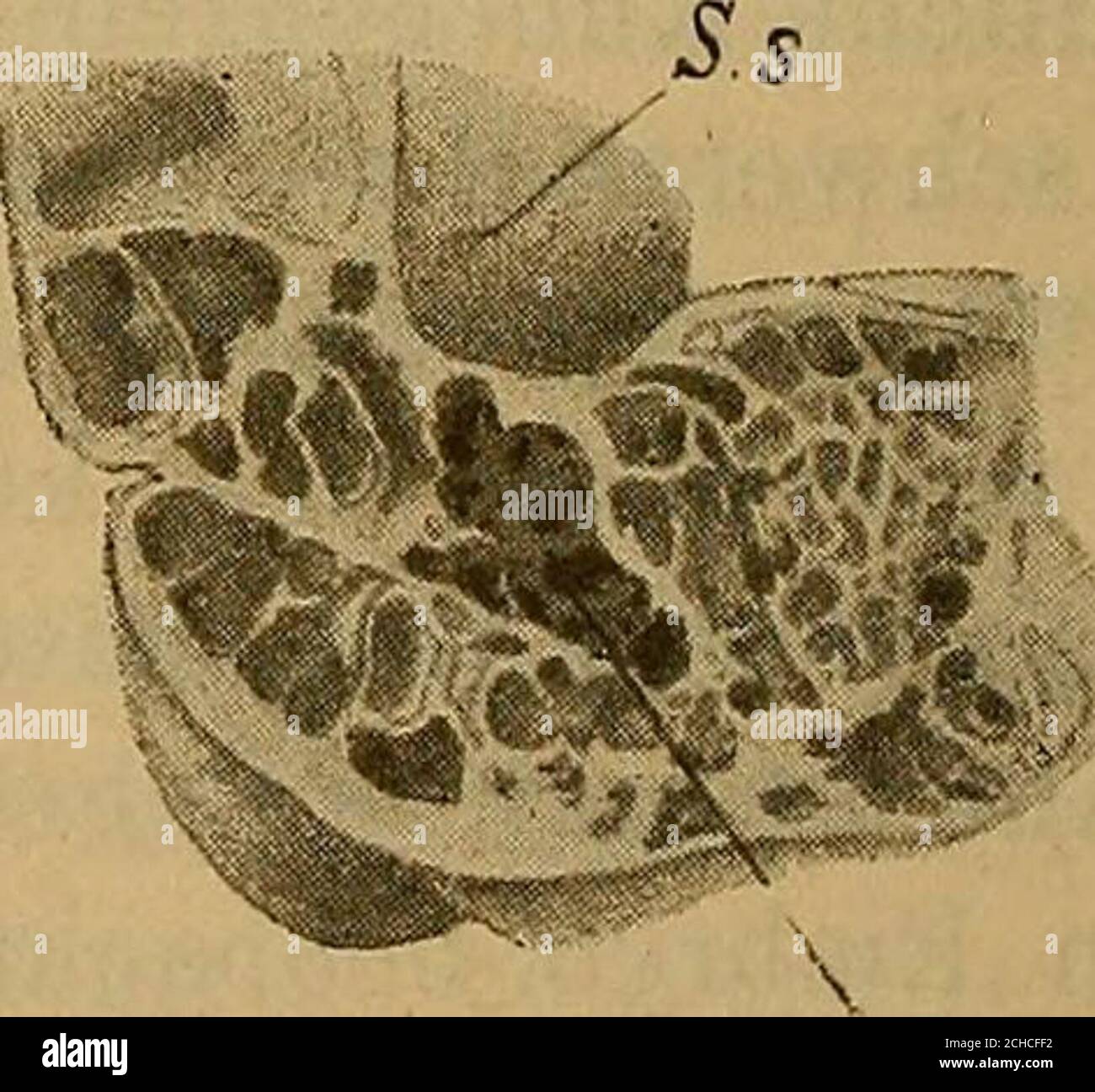 Processus mastoideus hi-res stock photography and images - Alamy