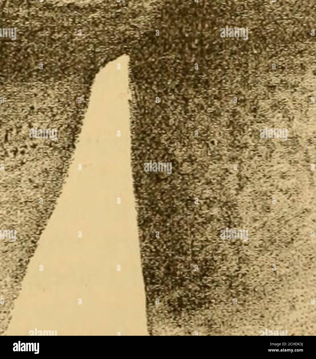 Papillary layer hi-res stock photography and images - Alamy