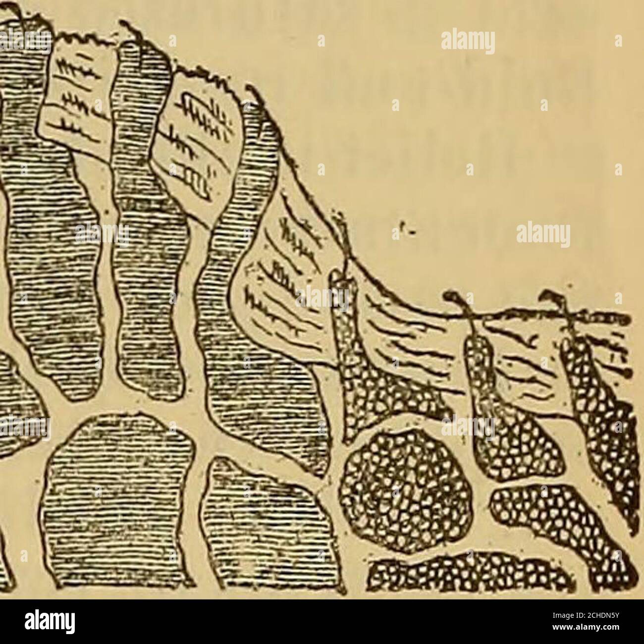 Ooze pus hi-res stock photography and images - Alamy