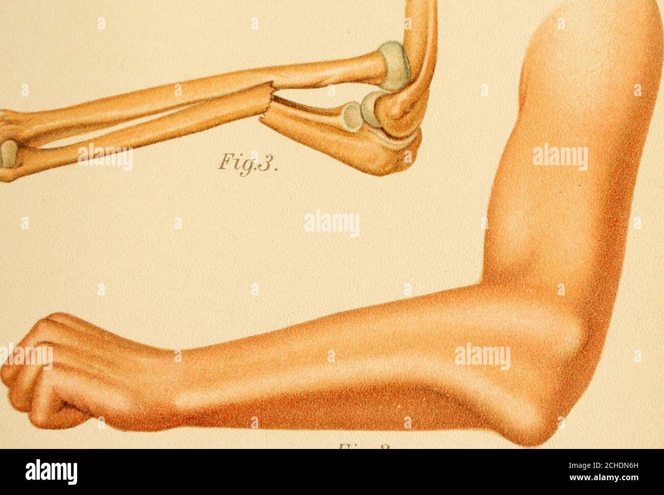 Flexion elbow hi-res stock photography and images - Alamy