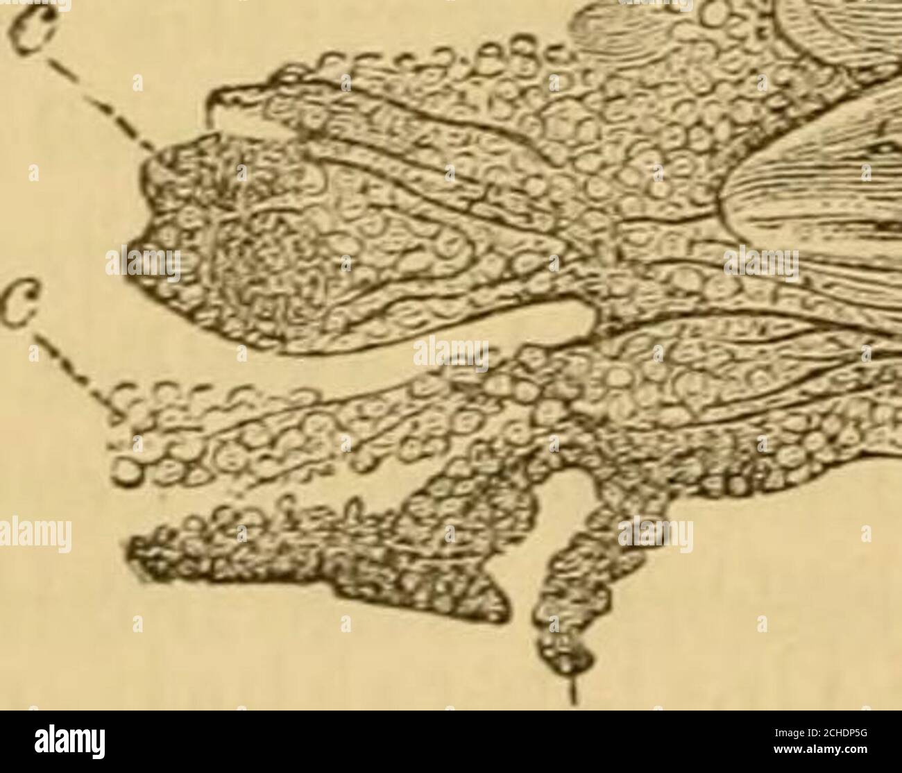 Pyaemia hi-res stock photography and images - Alamy