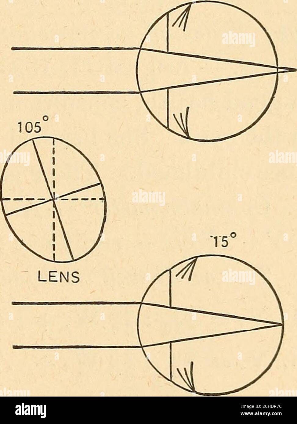 . The refraction of the eye; including a complete treatise on ...