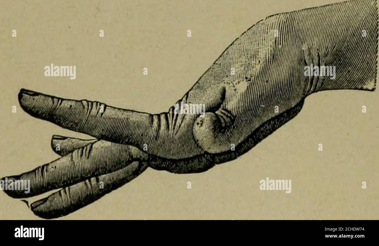 Control convulsions hi-res stock photography and images - Alamy