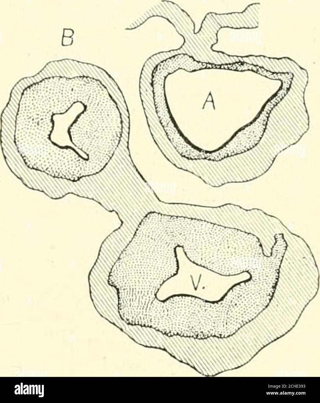 Human embryo heart development hi-res stock photography and images - Alamy