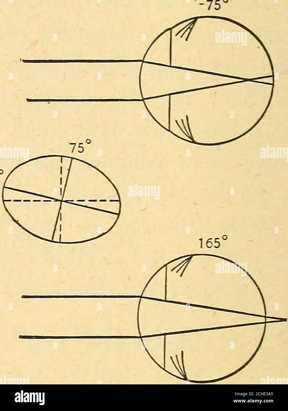 . The refraction of the eye; including a complete treatise on ...