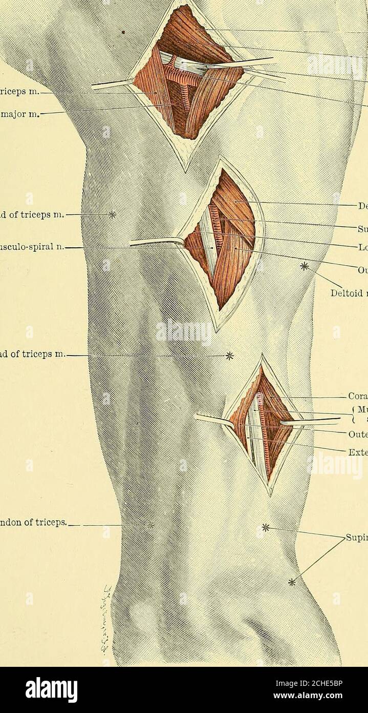 Radial incision hi-res stock photography and images - Alamy