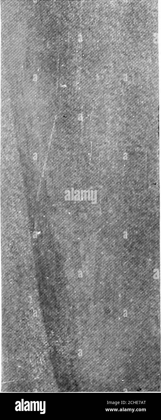 Tangential cross section Black and White Stock Photos & Images - Alamy