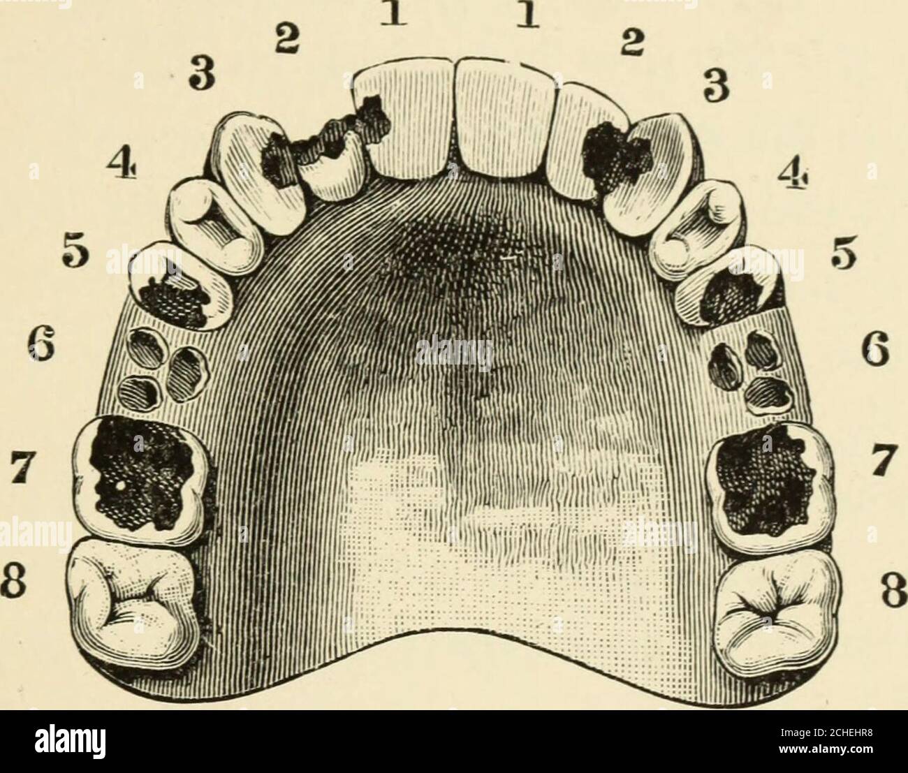 . The teeth in health and disease . ;Fig. 38. Fig. 38 shows the same ...