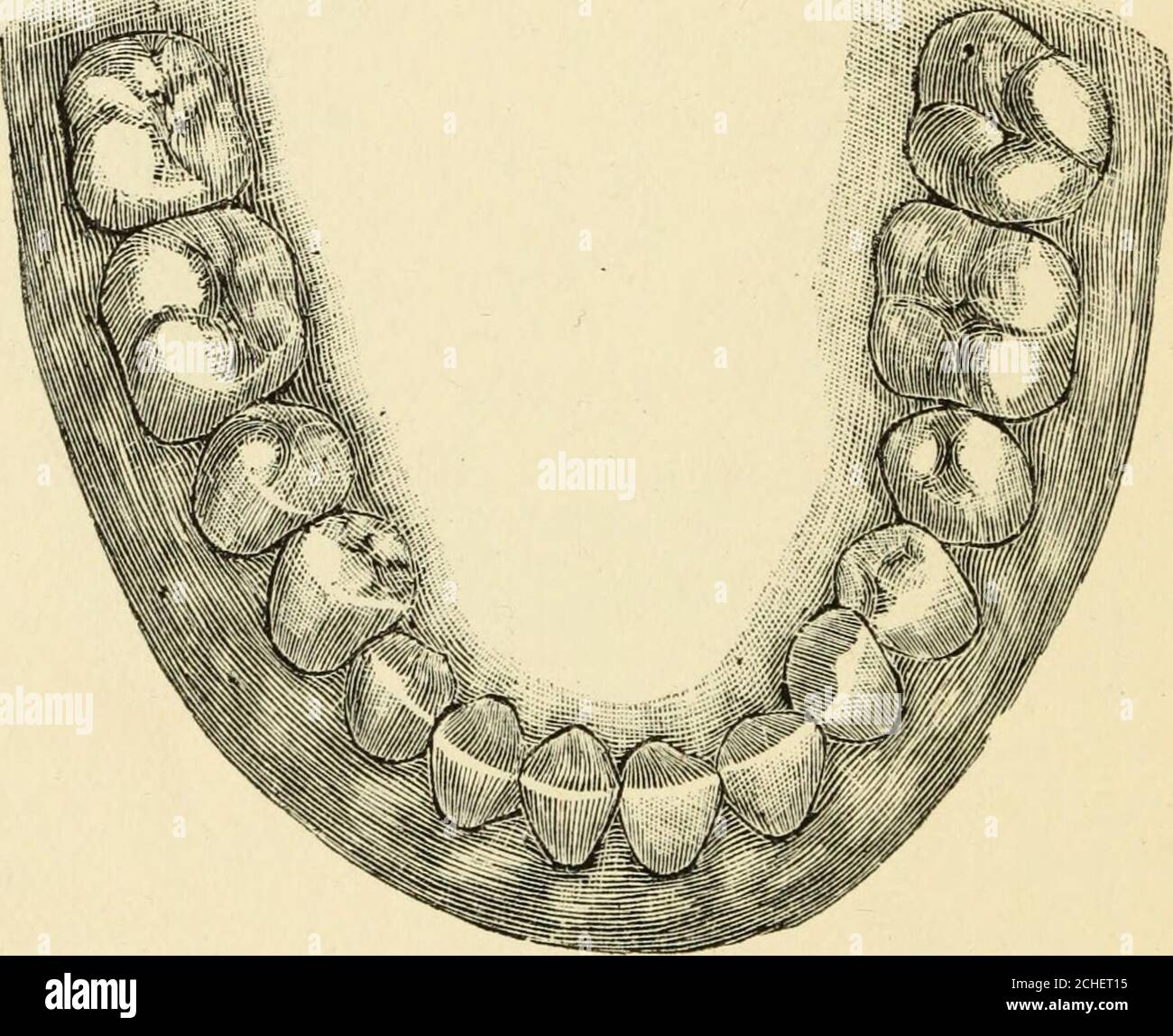 . The teeth in health and disease . Fig. 34. Figs. 33 and 34 show the ...