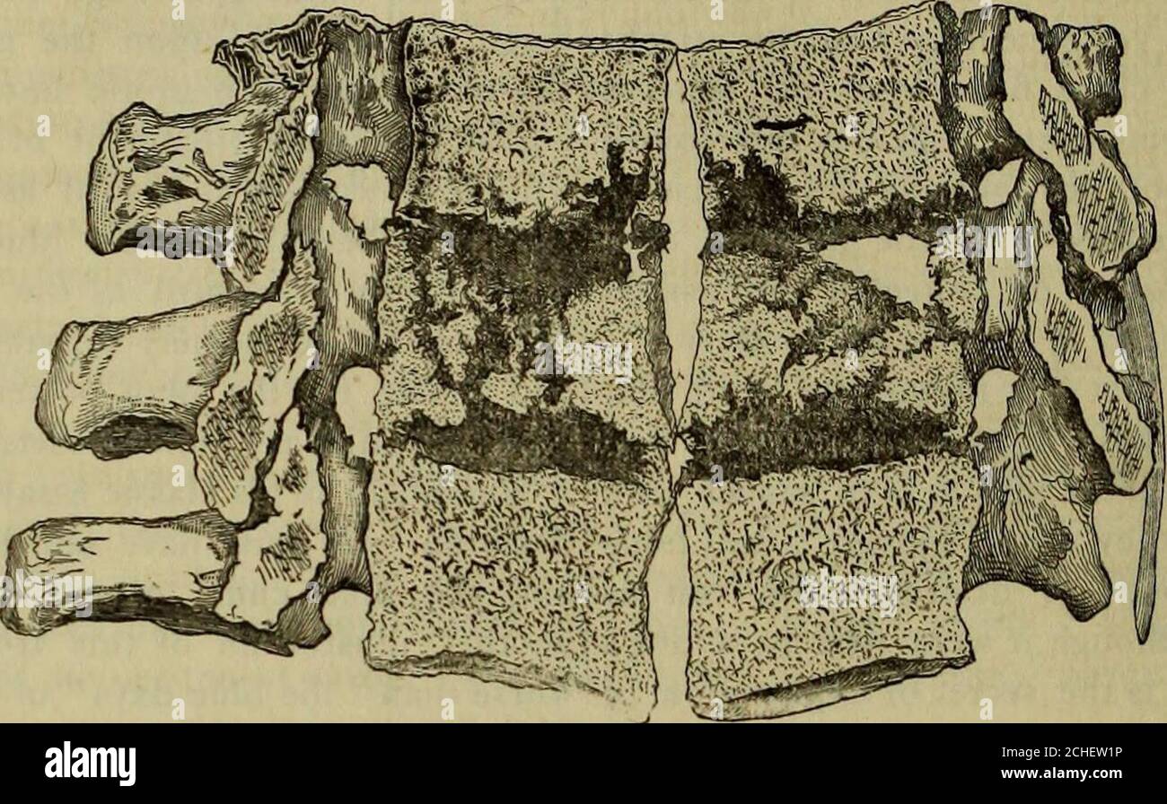 Fragments of cartilage hi-res stock photography and images - Alamy