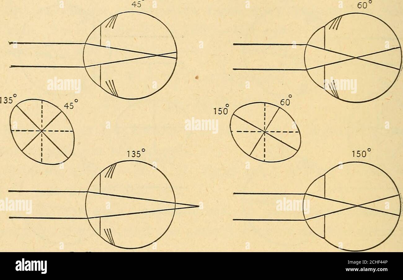 . The refraction of the eye; including a complete treatise on ...