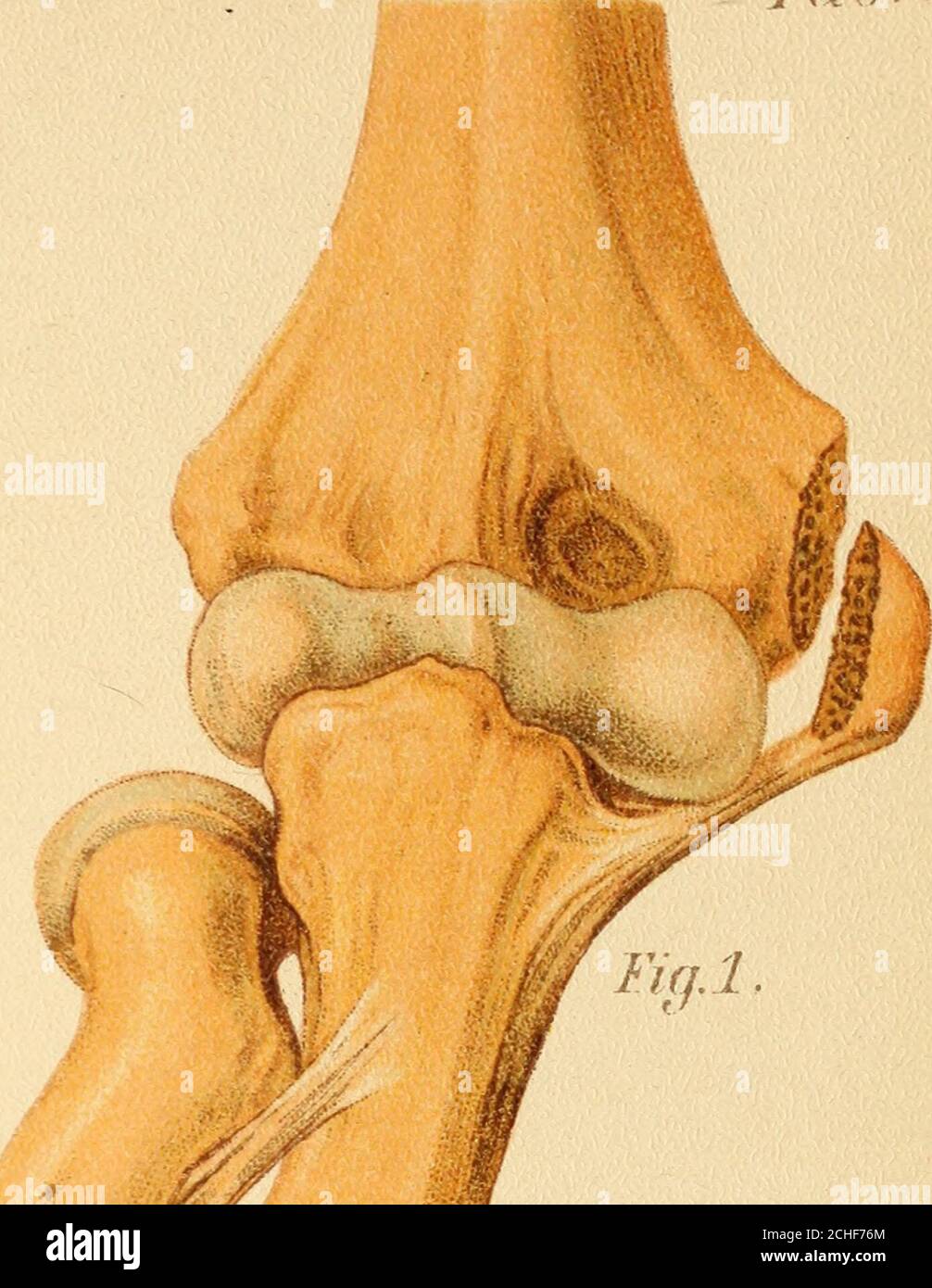 . Atlas and epitome of traumatic . there hasbeen extensive laceration ...