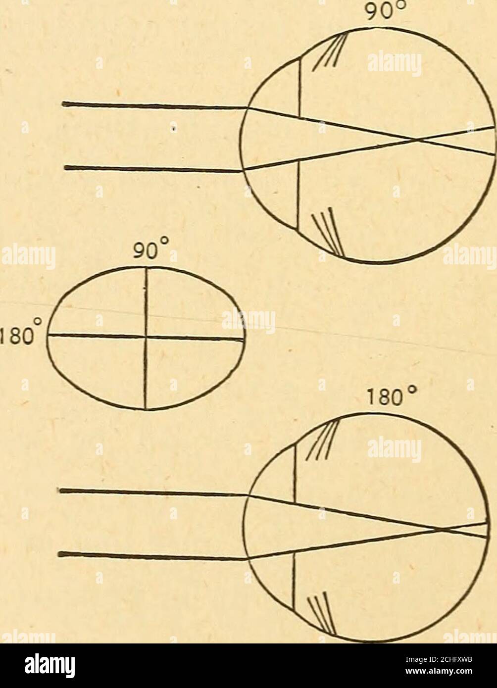 . The refraction of the eye; including a complete treatise on ...
