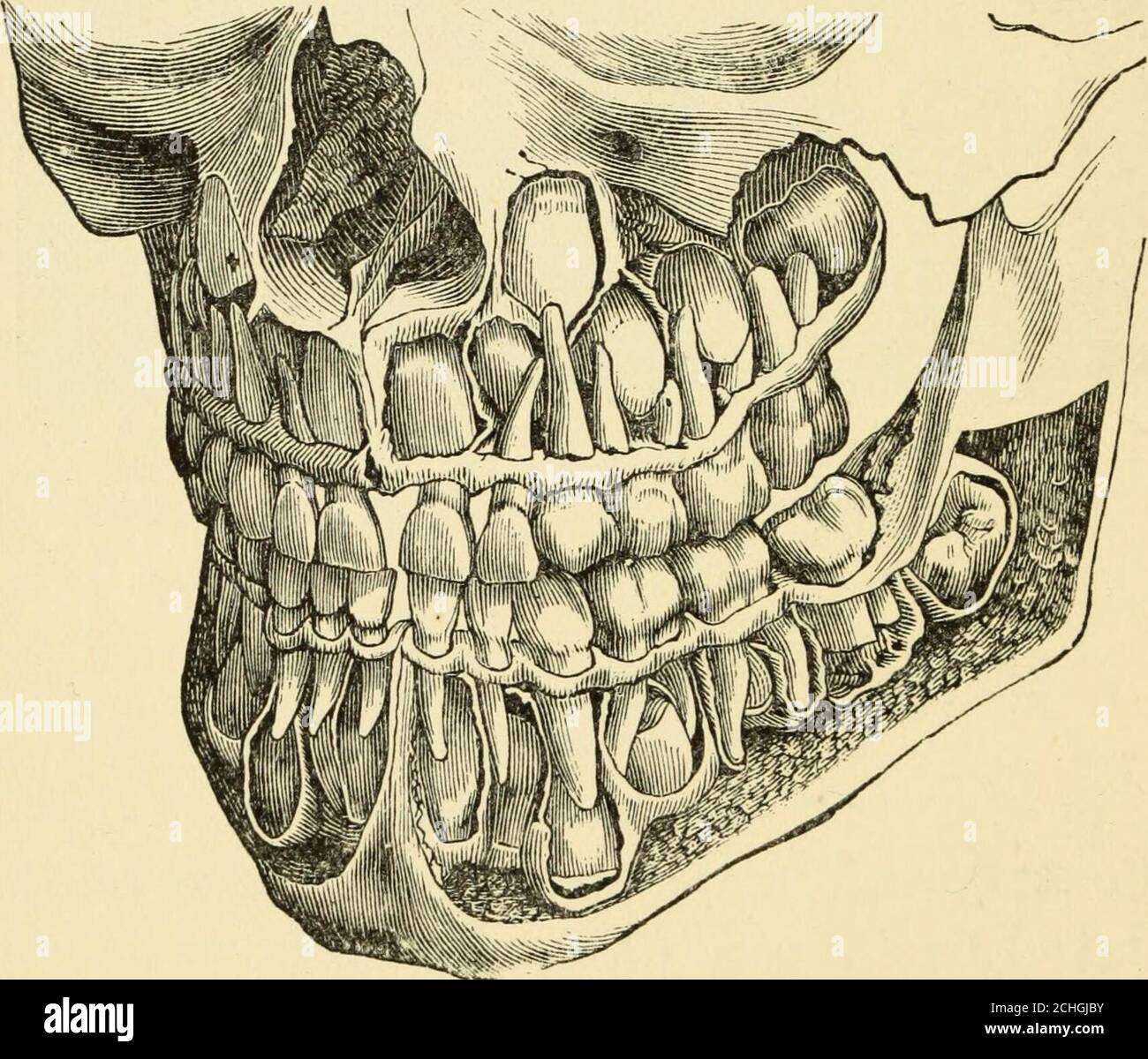 Lower cuspids lower teeth hi-res stock photography and images - Alamy
