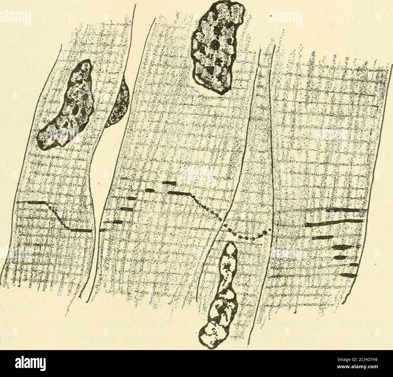 Cardiac muscle with intercalated discs hi-res stock photography and ...