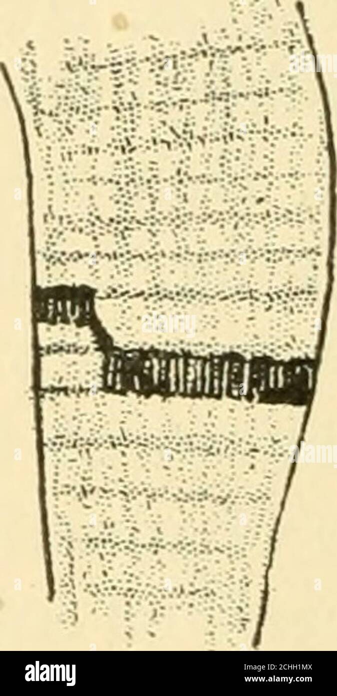 . The American journal of anatomy . J r. Fig. 3 Branching fiber of ...