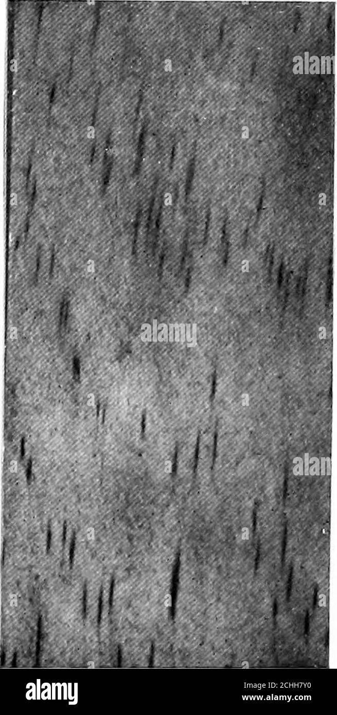 Tangential Section Of Pine Wood