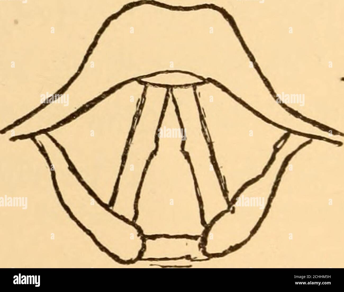 External incision hi-res stock photography and images - Alamy
