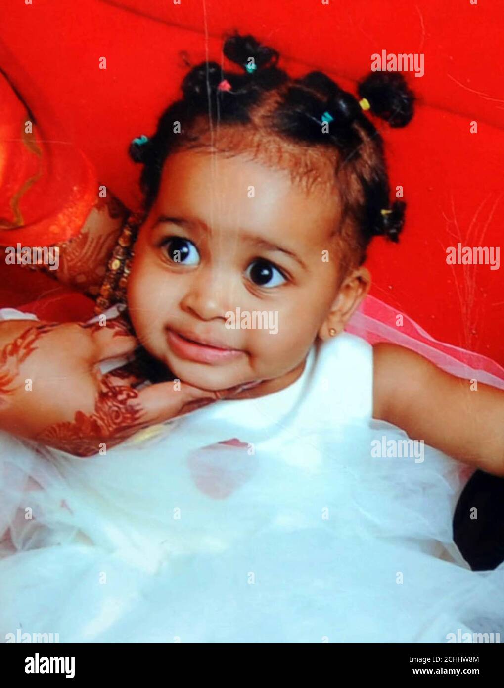 Septicaemia child hi-res stock photography and images - Alamy