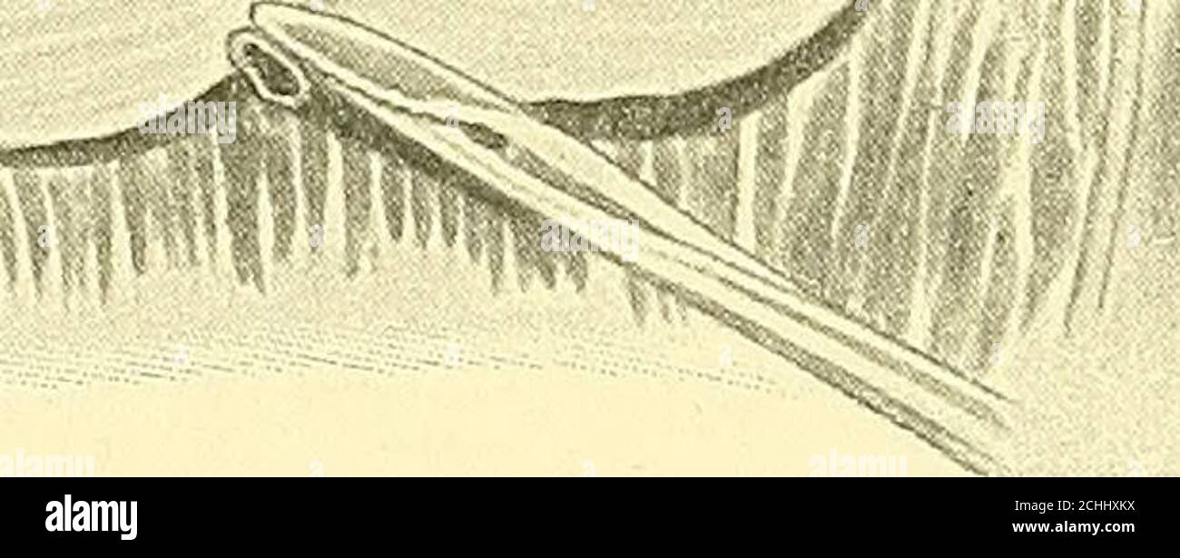 . Text-book of operative surgery . s ofinterrupted loop sutures may ...