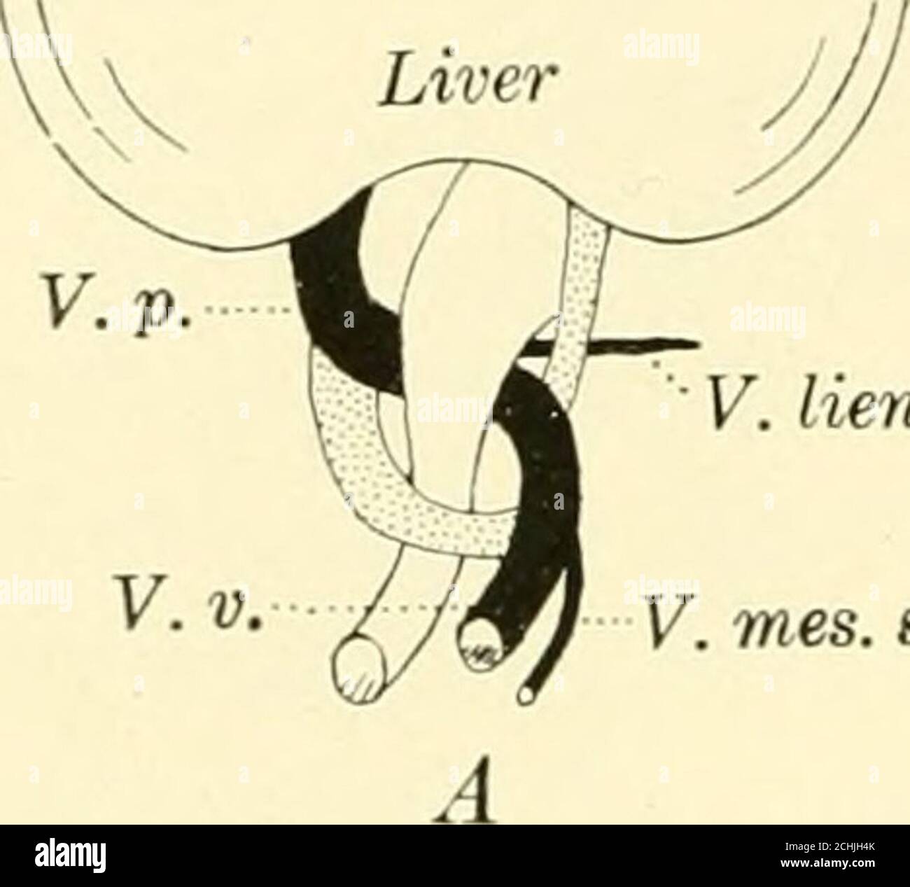 Superior mesenteric veins hi-res stock photography and images - Alamy