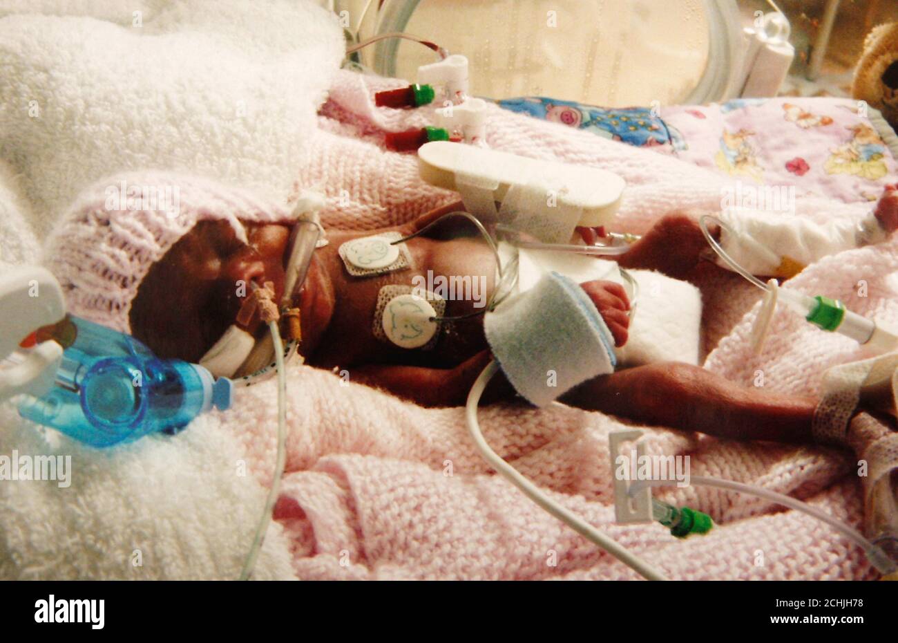 Undated collect photo of poppy davies hi-res stock photography and ...