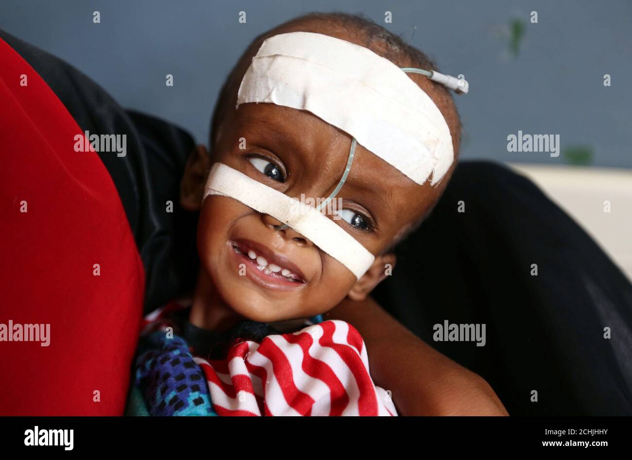 Nasogastric tube High Resolution Stock Photography and Images - Alamy