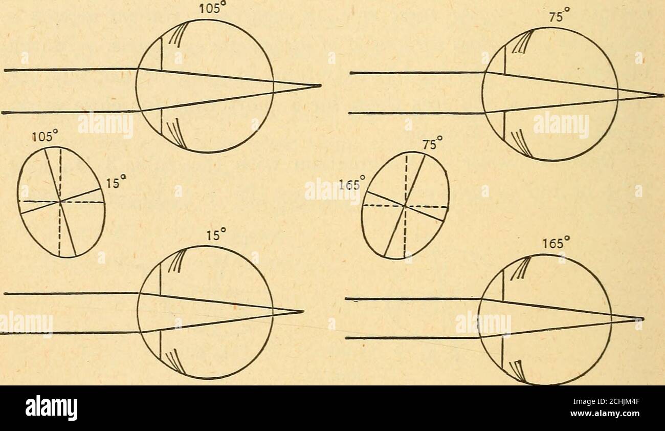 . The refraction of the eye; including a complete treatise on ...