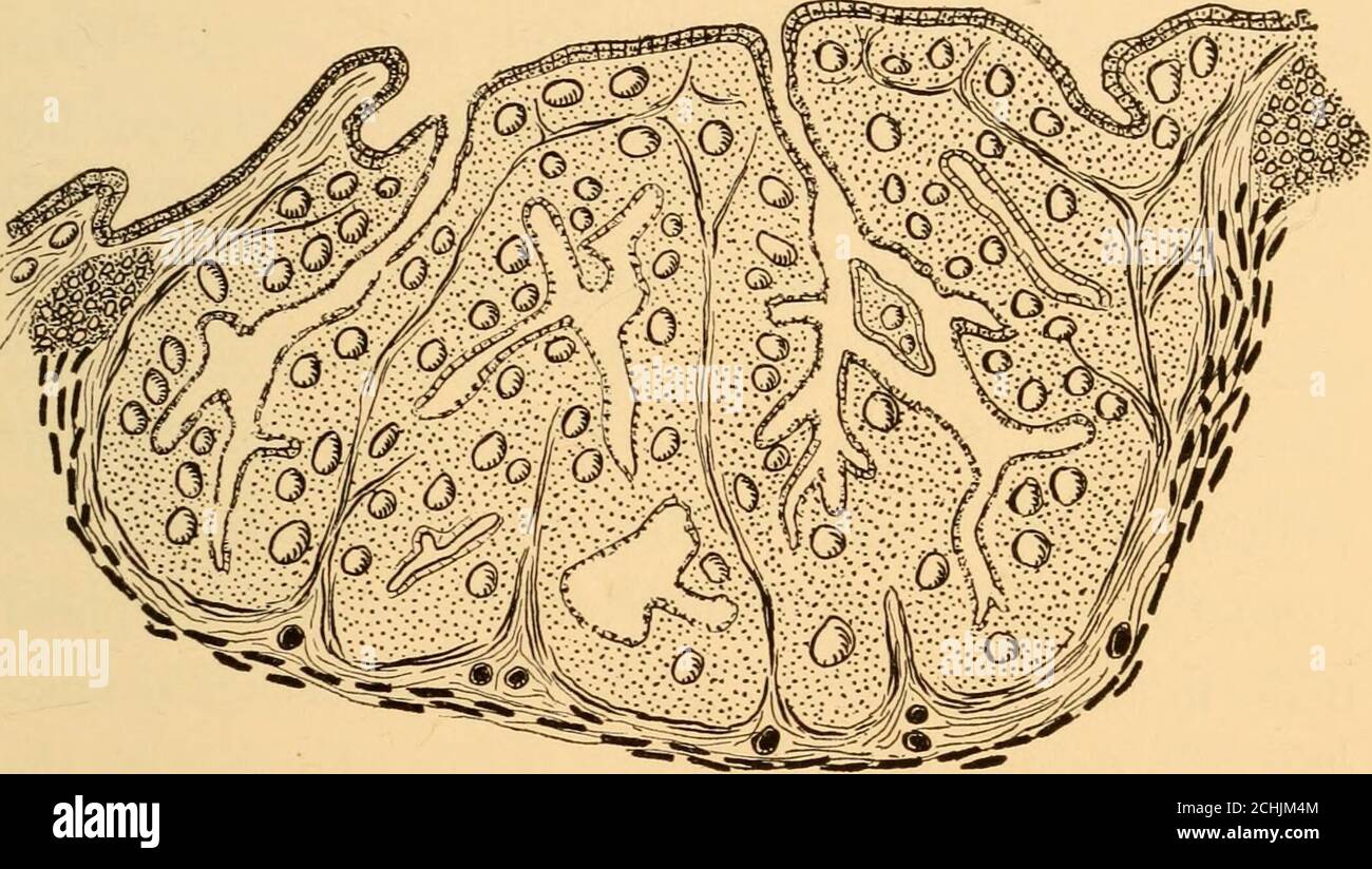 Lingual tonsil hi-res stock photography and images - Alamy