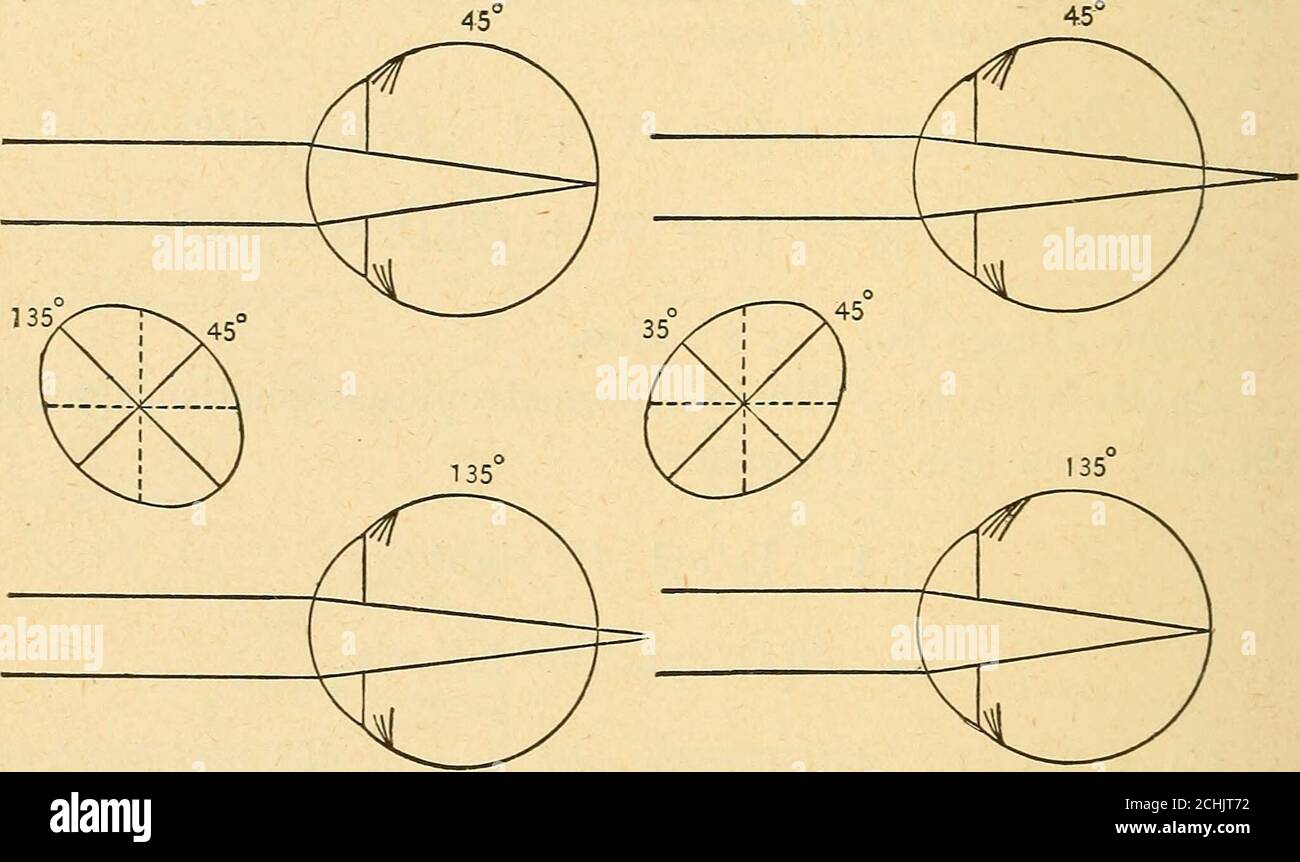 . The refraction of the eye; including a complete treatise on ...