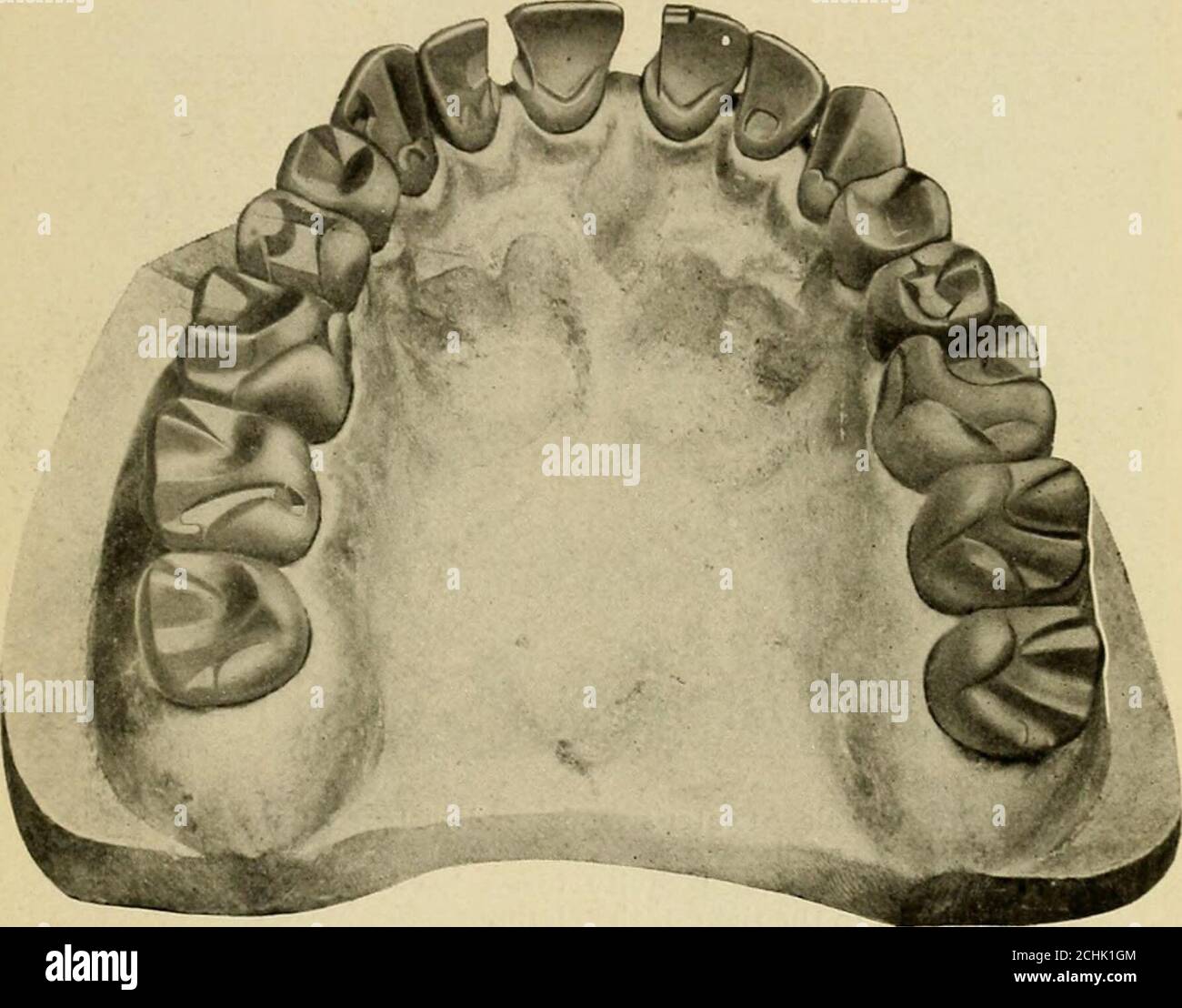 . Operative and dental anatomy technics; a class-room and laboratory ...