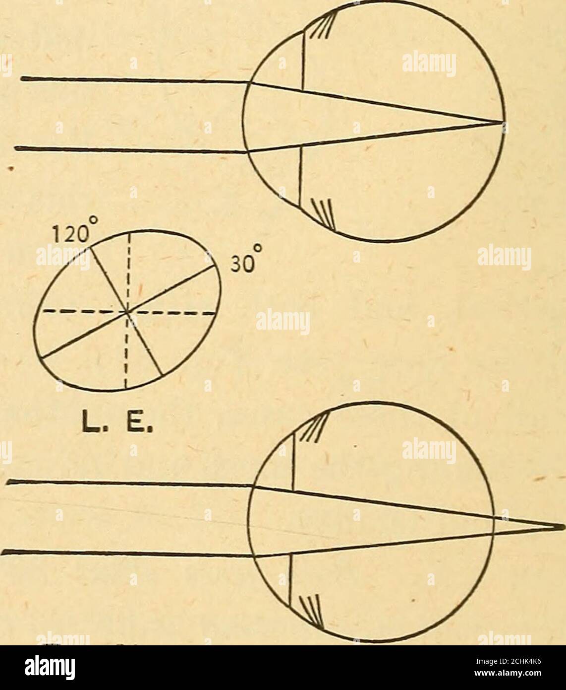 . The refraction of the eye; including a complete treatise on ...
