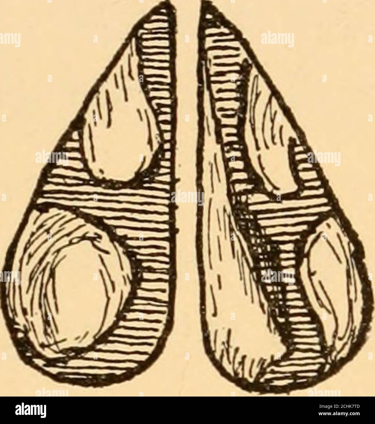 Nasal septum bending hi-res stock photography and images - Alamy