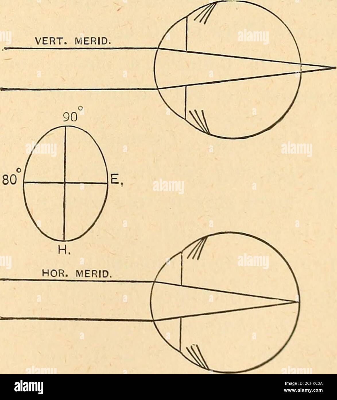 . The refraction of the eye; including a complete treatise on ...