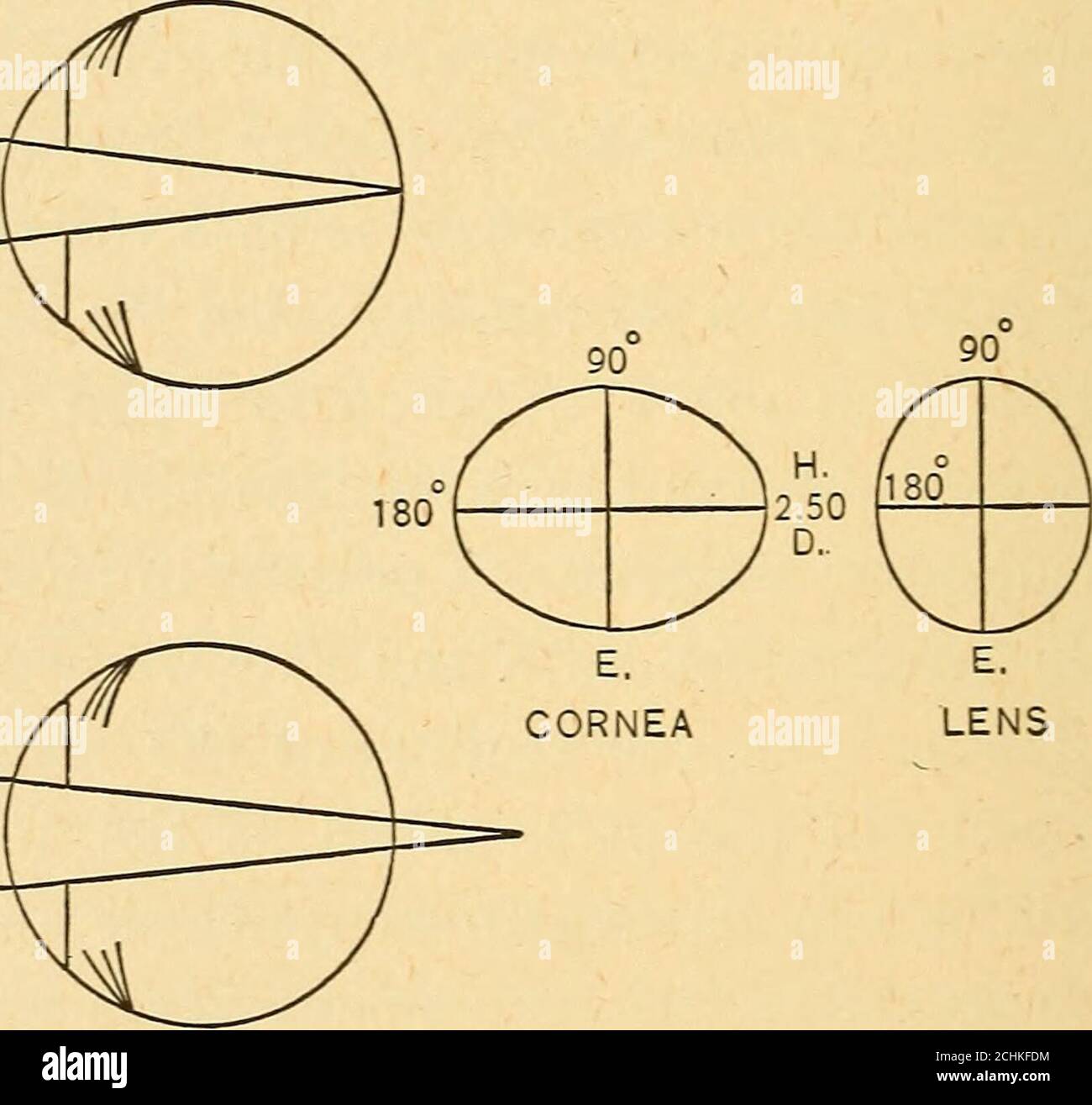 . The refraction of the eye; including a complete treatise on ...