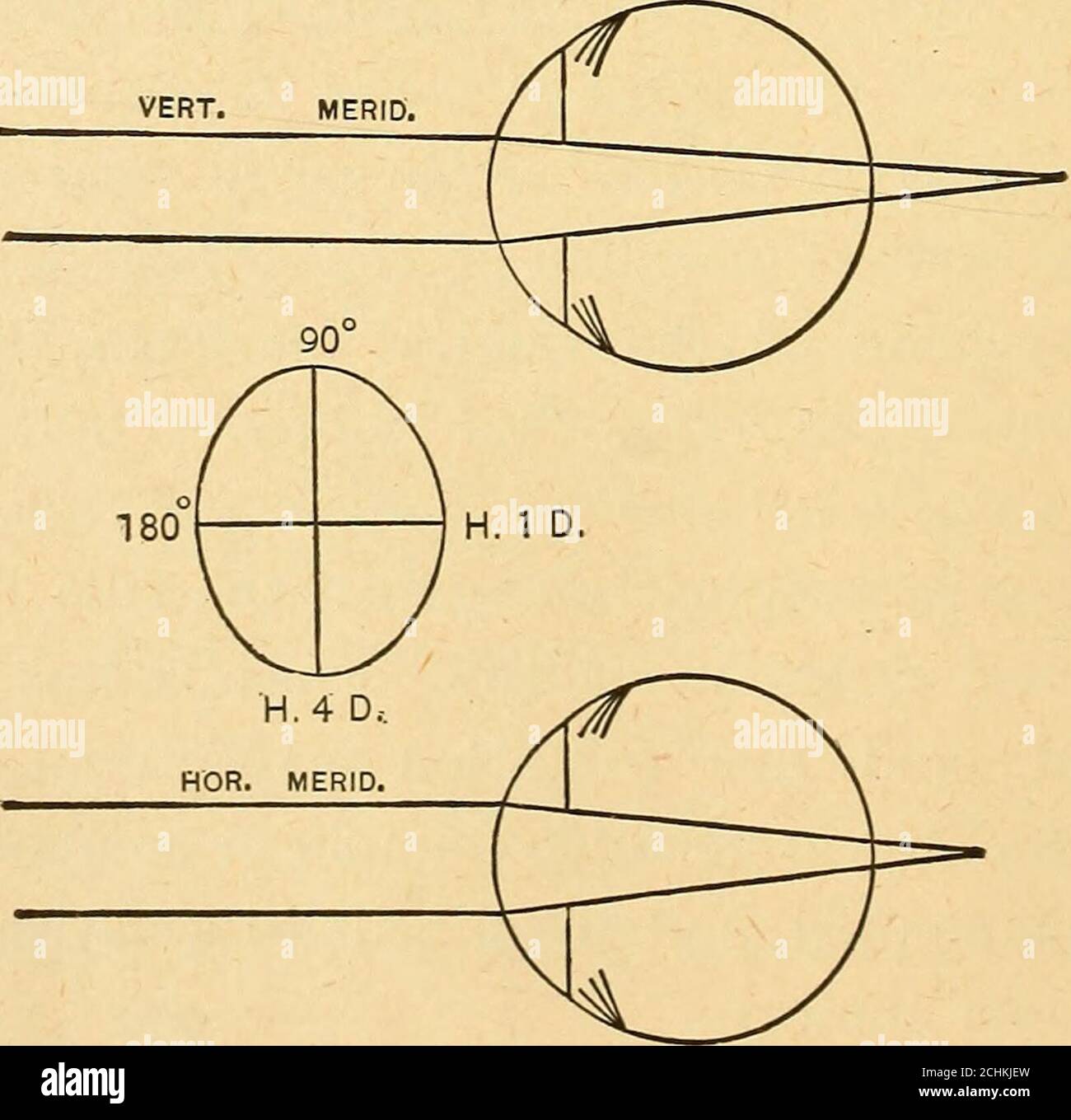 Hypermetropic hi-res stock photography and images - Alamy