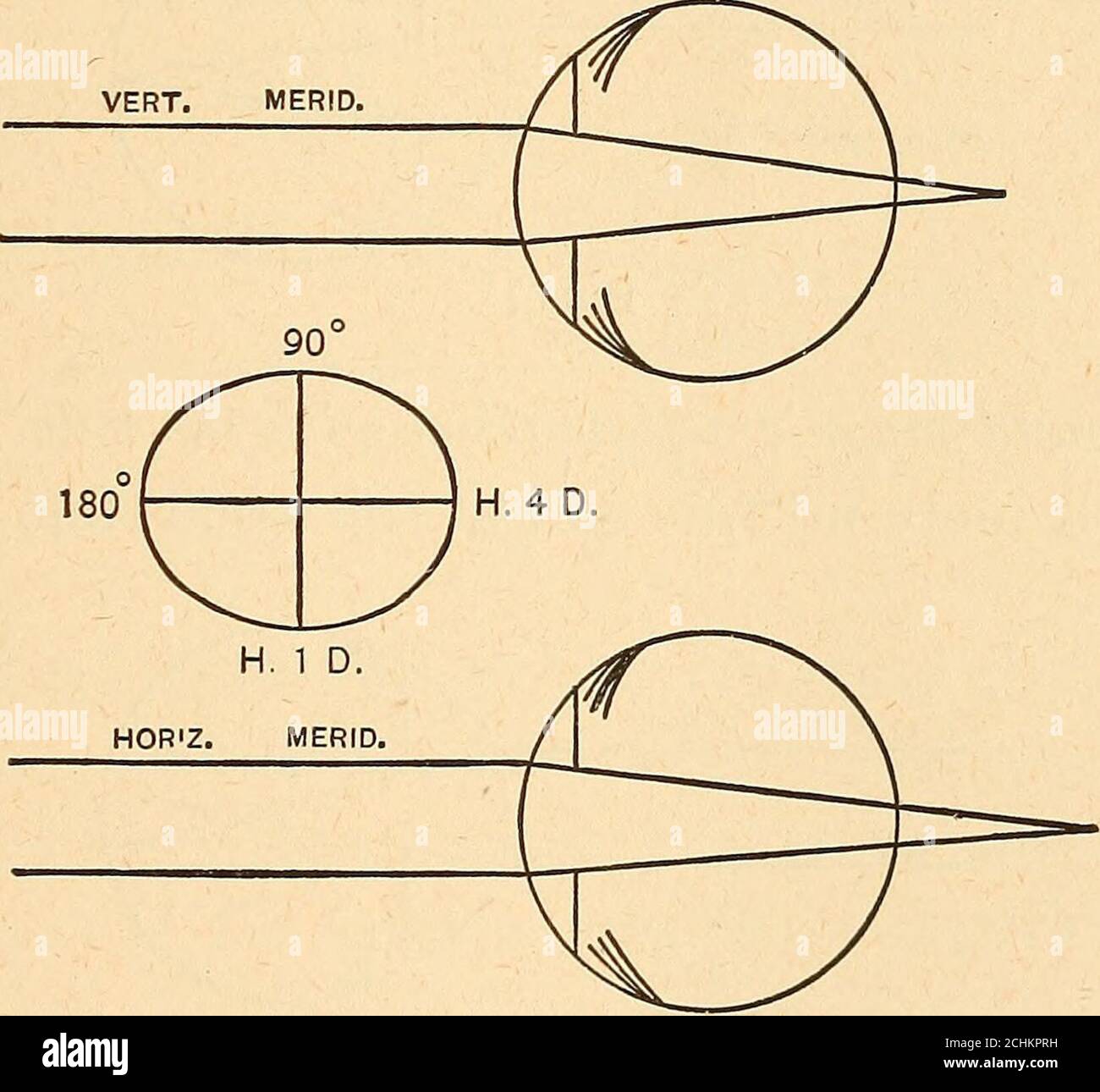 . The refraction of the eye; including a complete treatise on ...